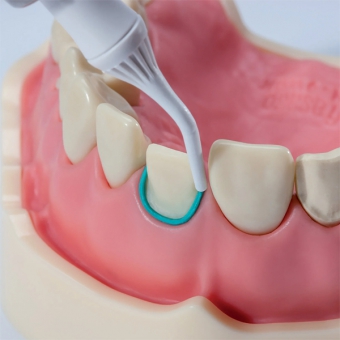 Retraction Paste 25 X 0.37g - Next Dental UK